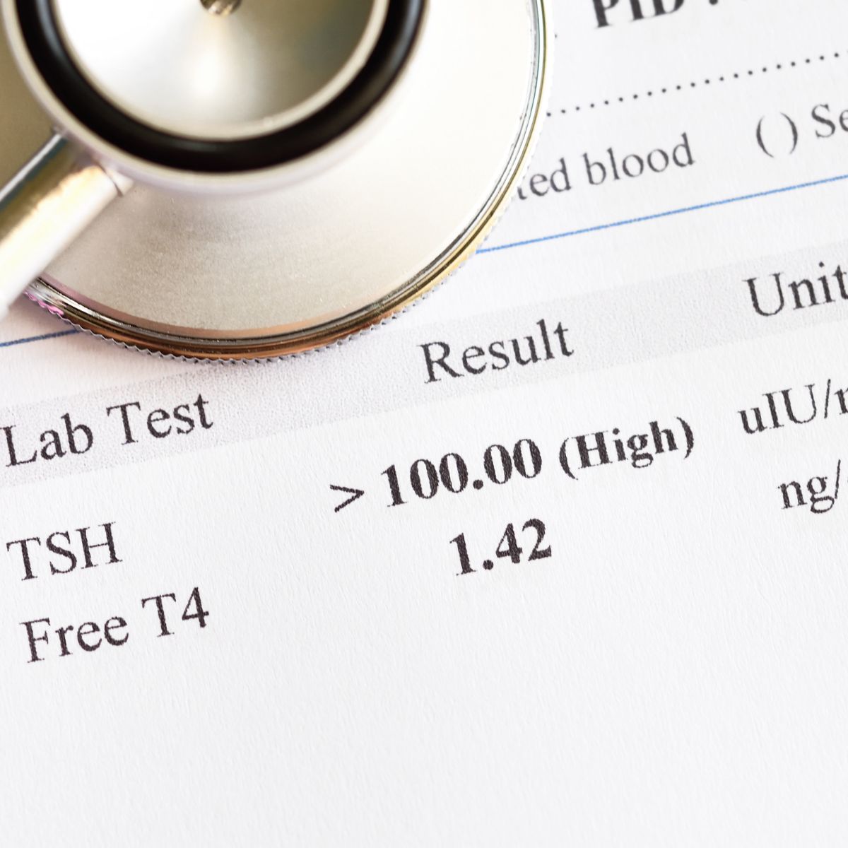 Is a Hormonal Imbalance Causing Your Acne? – Emme Diane