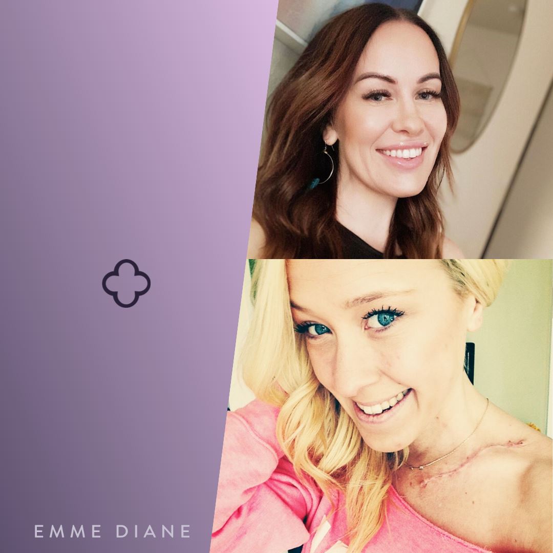 2 Emmebabe Stories of Melanoma Recovery and Lessons Learned – Emme Diane