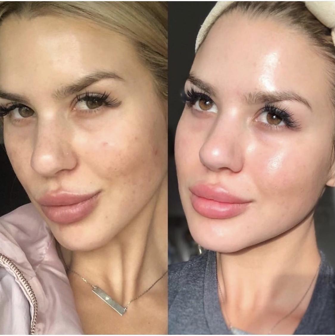 Firming Peptide Serum | Hydrating Peptide Complex for Anti-Aging – Emme ...